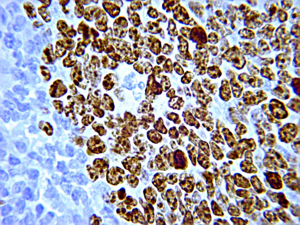 Anti-Ki-67 Antibody | AB9260